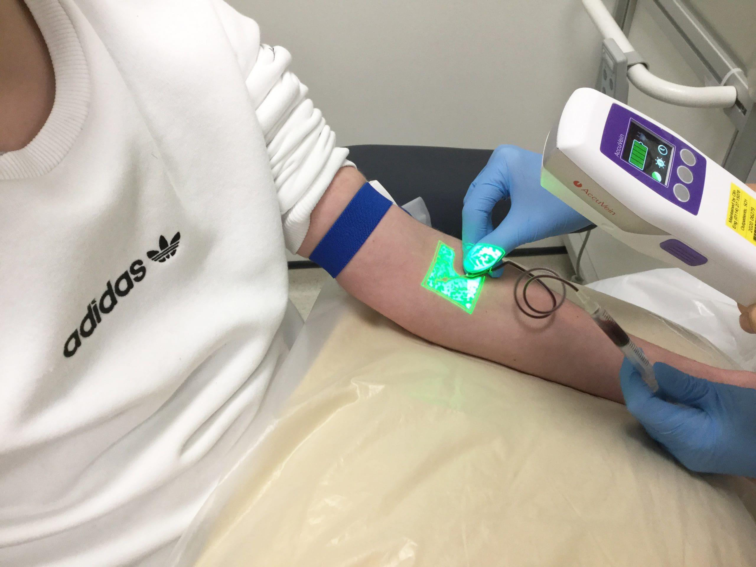 New vein scanner makes blood tests easier | MedEquip4Kids